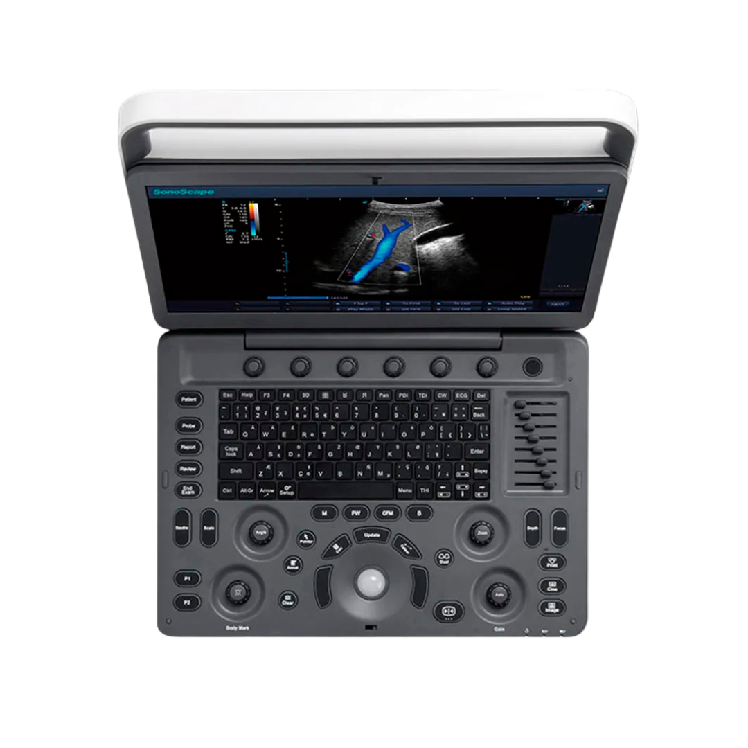Ultrassom Portátil E2 SonoScape - Cardioequipo
